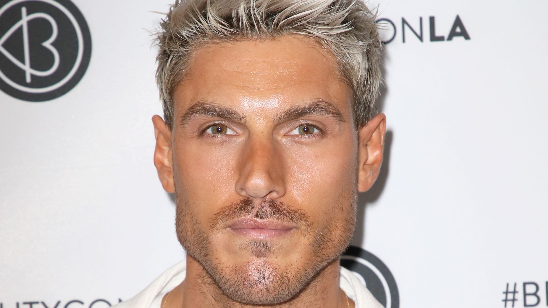 Bescheiden: Das wünscht sich Chris Appleton für Hochzeitstag