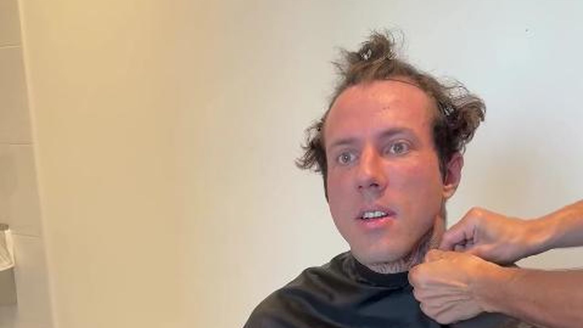 Zu viel Stress: Christian Wolf brauchte Haartransplantation!