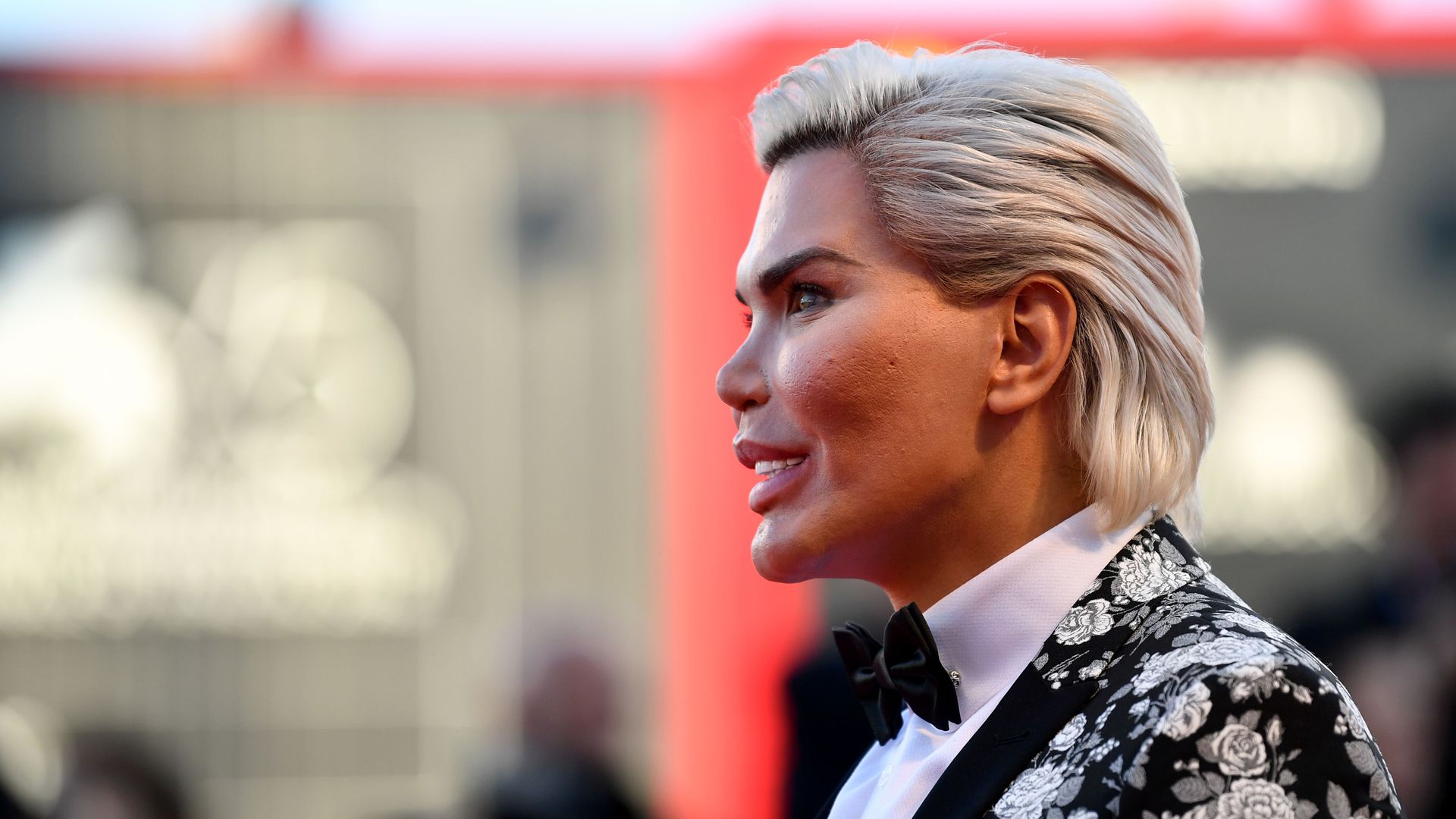 Real-Life-Ken Rodrigo Alves hatte sechs OPs auf einen Schlag ...
