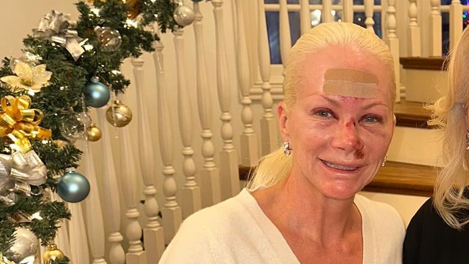 Vor Heiligabend: Shawne Fielding wurde im Uber angegriffen!