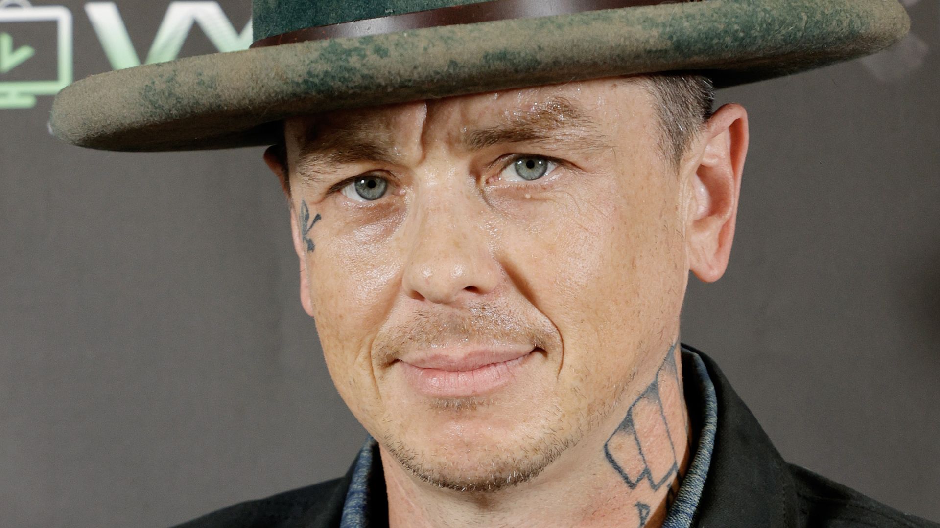 Nach schweren Verbrennungen: Sid Wilson aus Klinik entlassen