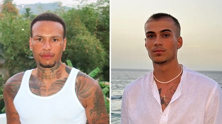 GNTM-Boy Ryan Wöhrl zeigt Ergebnisse von Haartransplantation