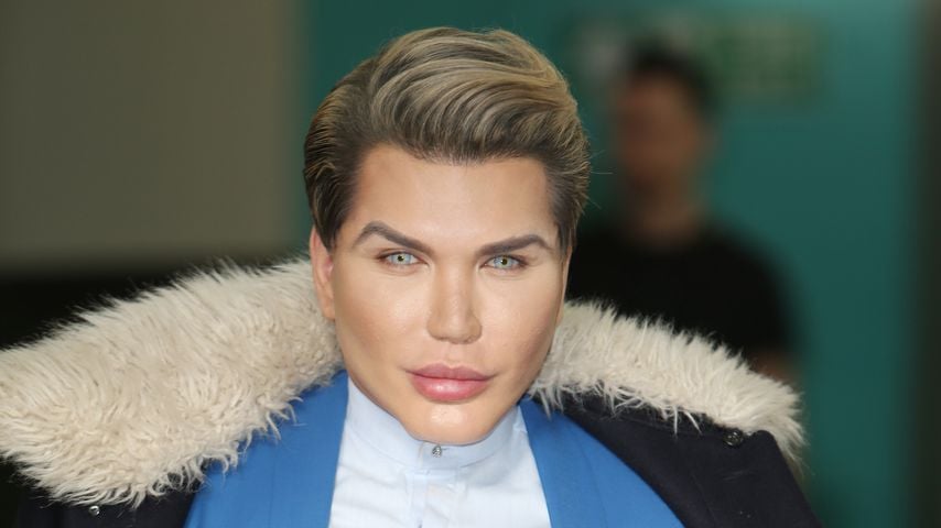 OP-Wunder Rodrigo Alves: Image als "Real-Life-Ken" nervt ihn ...